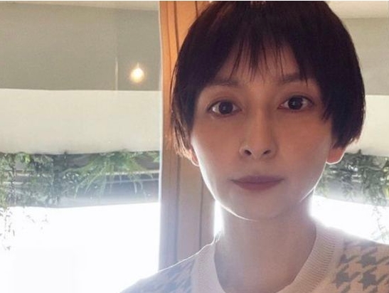 톱女배우 “피부 하얗게 되는 질환 …언제까지 버틸지” – KNEWSLA